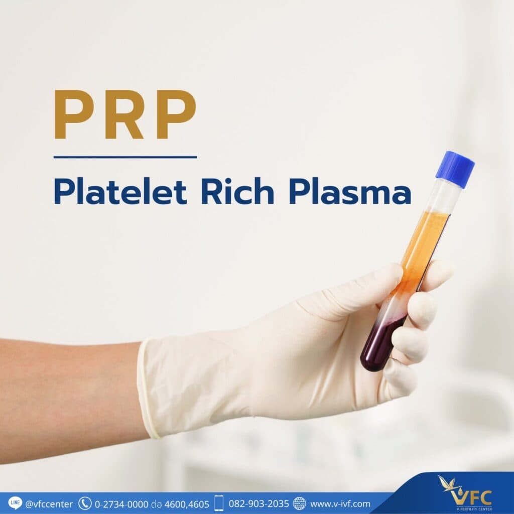 Platelet Rich Plasma (PRP) คืออะไร? - v-ivf.com
