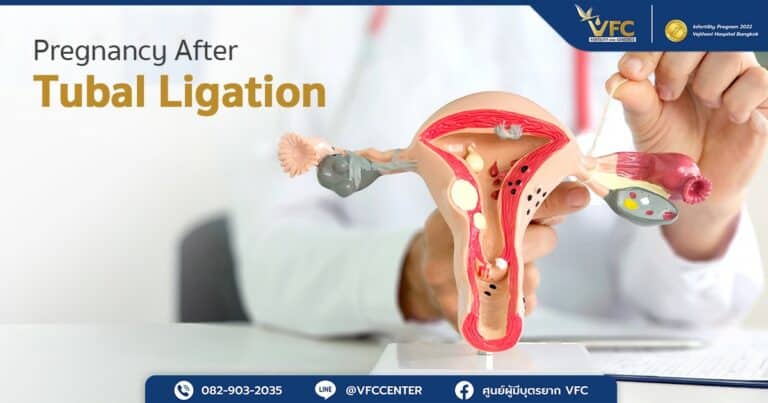 Pregnancy After Tubal Ligation | V Fertility Center (VFC)