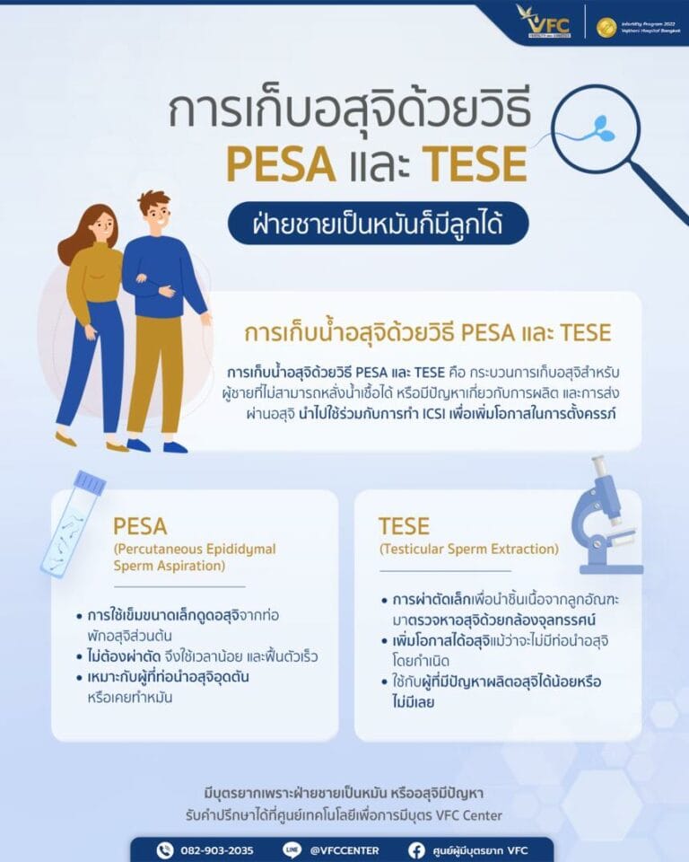 รู้จักการเก็บอสุจิด้วยวิธี PESA และ TESE ต่างกันอย่างไร?