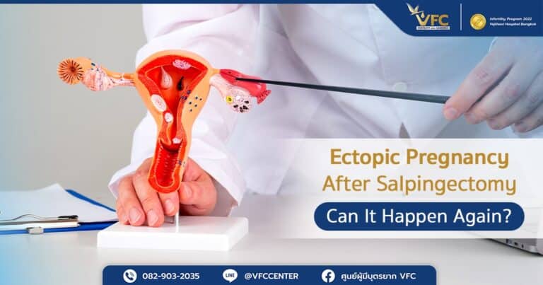 Ectopic Pregnancy After Salpingectomy: Can It Happen Again?