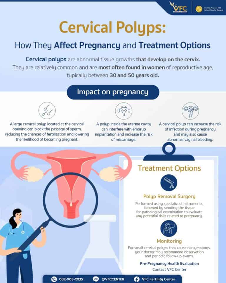 Is a Cervical Polyp Dangerous? Pregnancy Tips You Need - v-ivf.com
